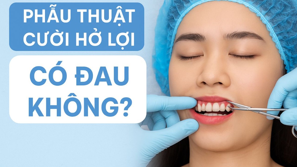 Phẫu thuật cười hở lợi có đau không? Những điều cần lưu ý